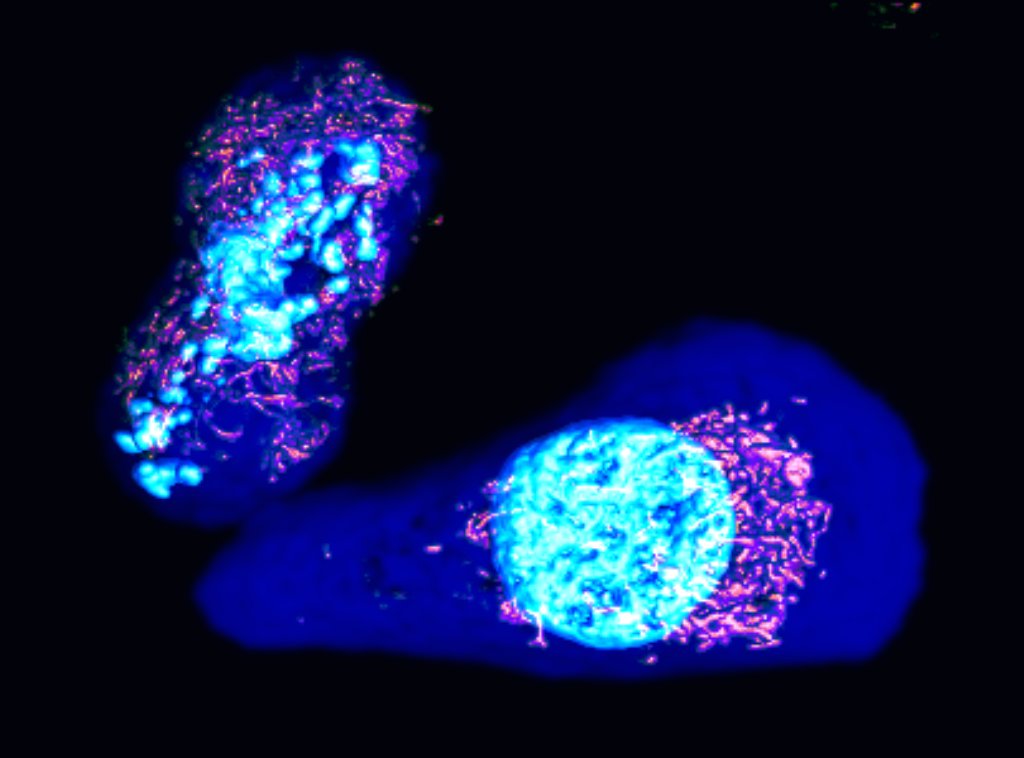 Cancer_Cells_Alive – Centre for Systems Medicine